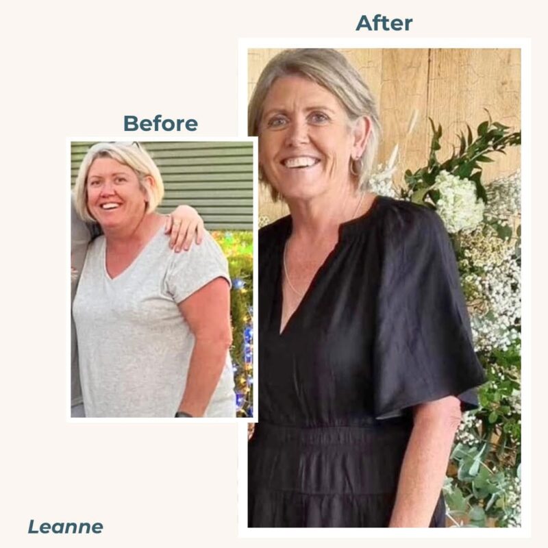 Gallery | BetterLife Surgery