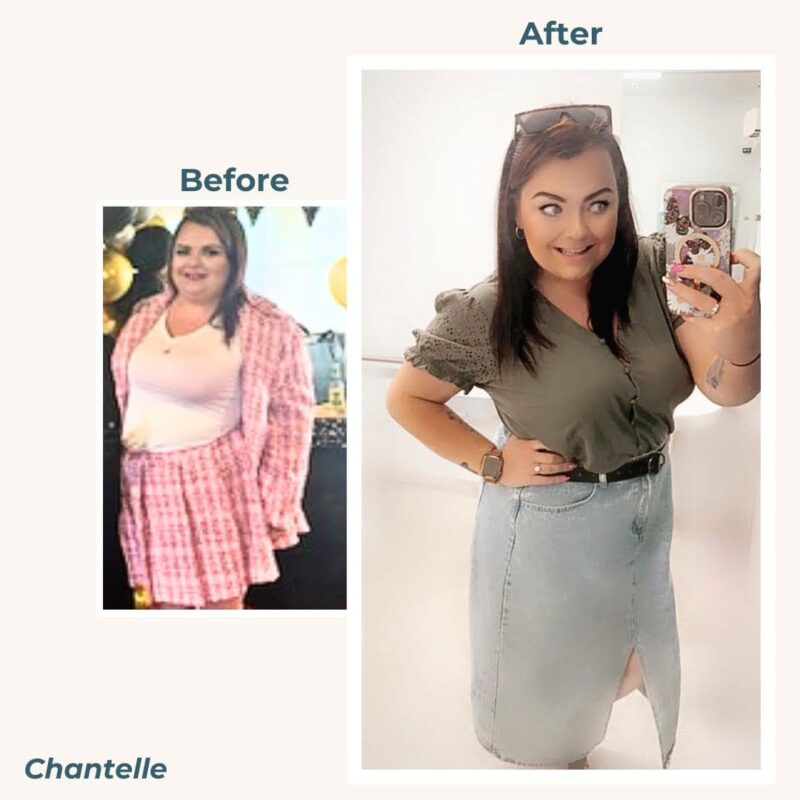 Gallery | BetterLife Surgery