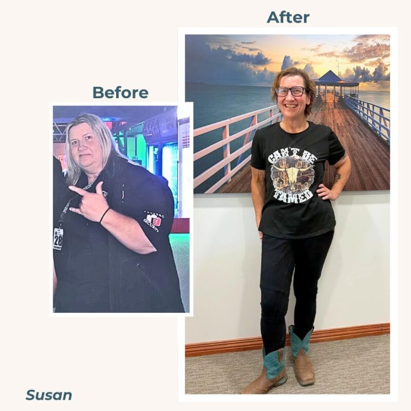 Gallery | BetterLife Surgery
